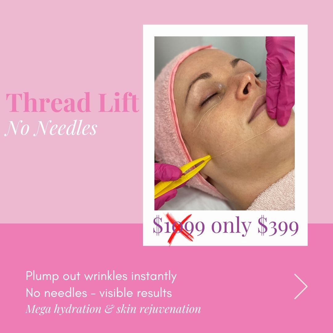 THREAD LIFT NO NEEDLES – The Rejuv Lab